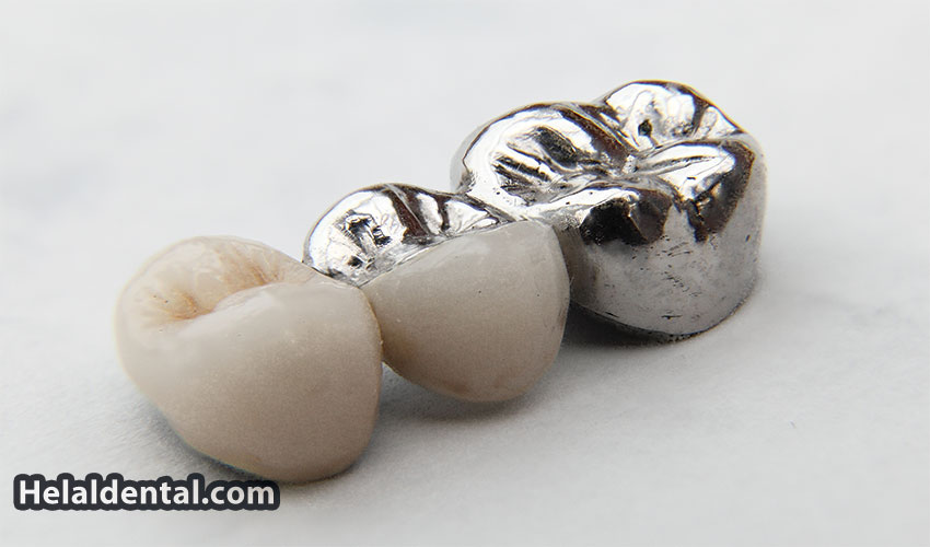 Helal Dental Orthodontic Instruments and Dental Equipment